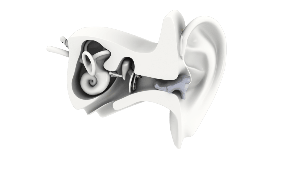 Unique Technology | Earlens